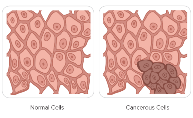 What is Cancer | Let's Talk About Cancer